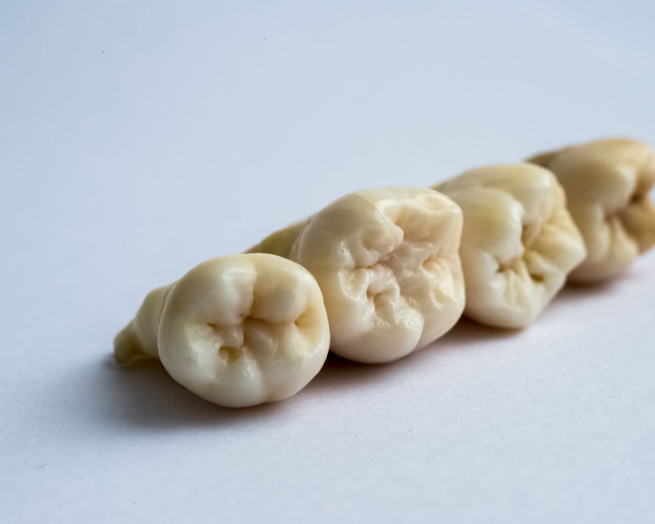 ¿Si una muela se mueve hay que extraerla? | Soludental